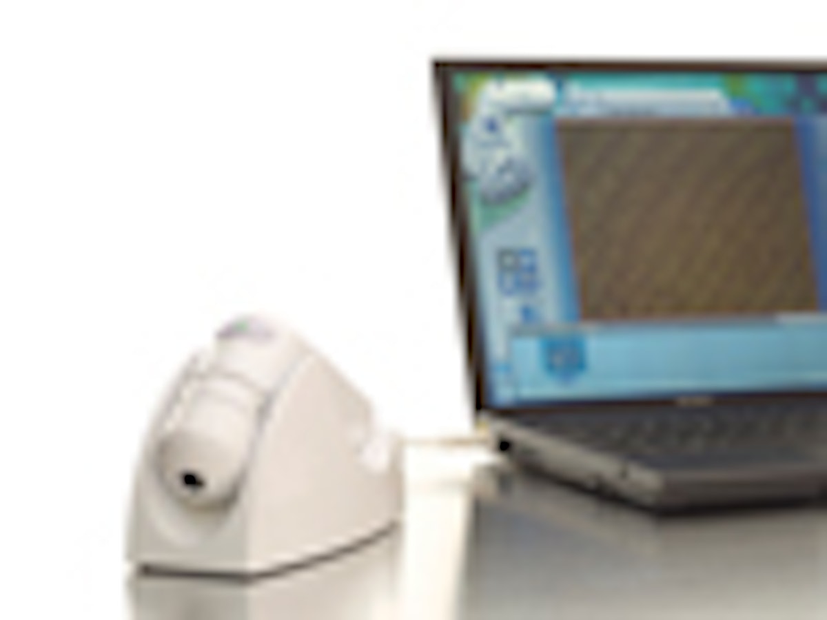 Moritex Clarity Skin Advisor System 1000 | Skin Inc.