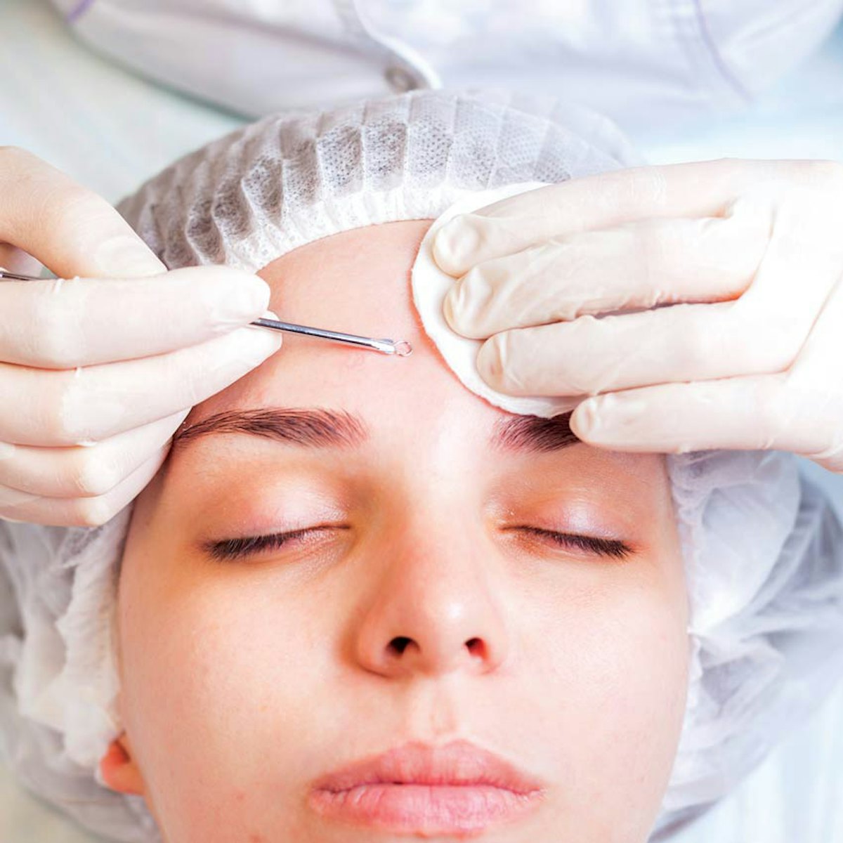 Controlling Acne with Assessment, Diagnosis and Treatment | Skin Inc.