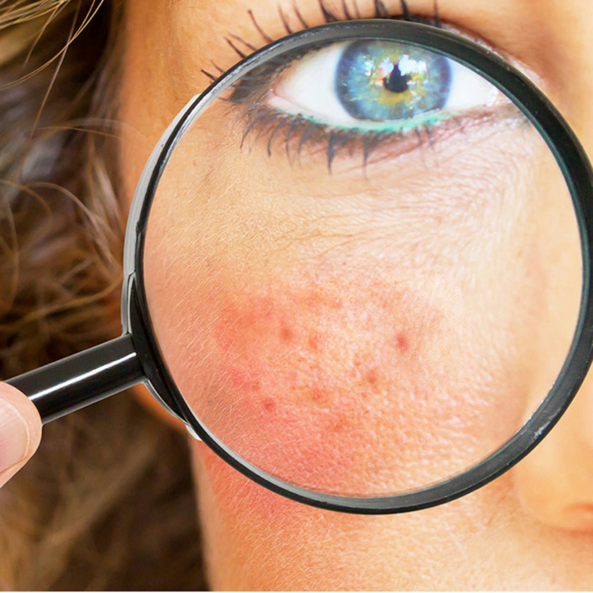 Reflections: You're Blushing | Skin Inc.