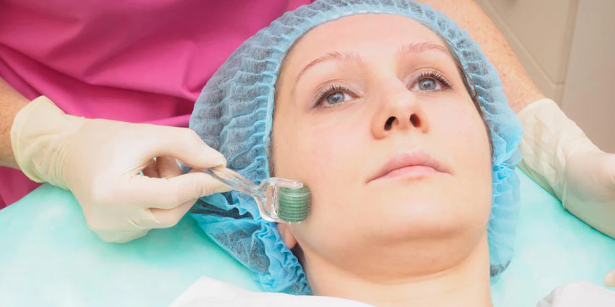 [VIDEOS] Can Estheticians Perform Microneedling? | Skin Inc.