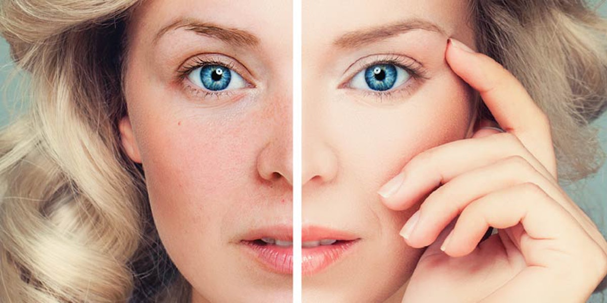 An Esthetician’s Guide to Vascular Lesions | Skin Inc.