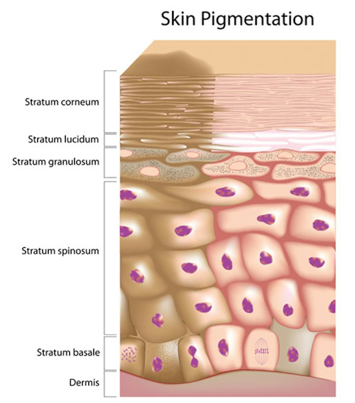 basal cell layer pigmentation