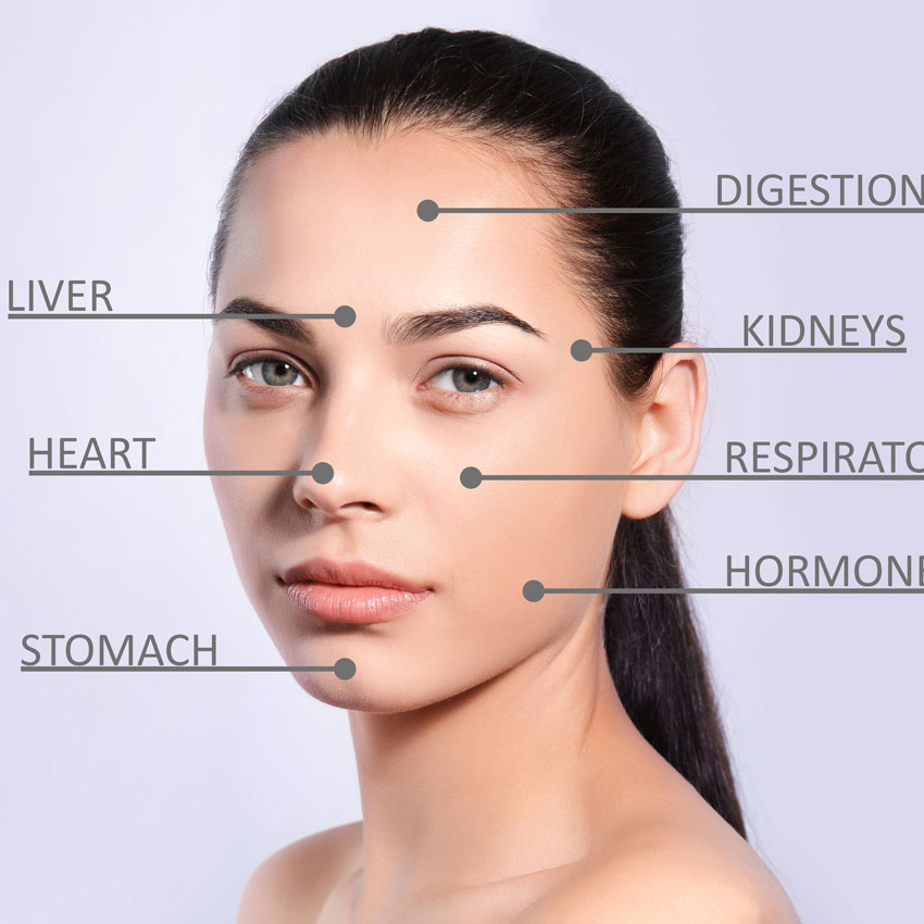 Acne Diagram Of The Face